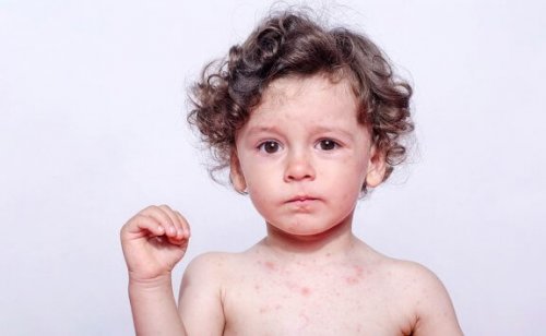 Les causes de l' allergie à la sueur chez les enfants - Être parents